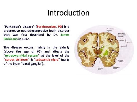 Anti Parkinsons Drugs New Pharmacology Pdf