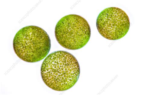 Eremosphaera Viridis Algae Light Micrograph Stock Image C057 4932 Science Photo Library