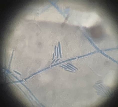 100Â Magnified View Of Banana Shaped Macroconidia Of Fusarium Download Scientific Diagram