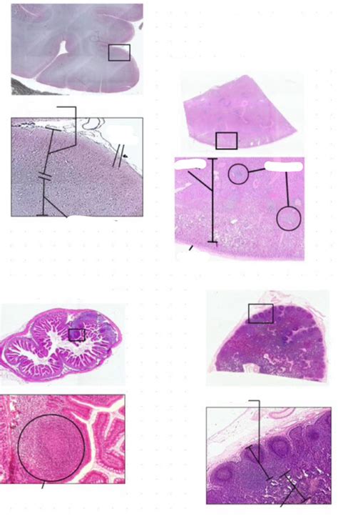 Lymph Node And Spleen Histology Diagram Quizlet