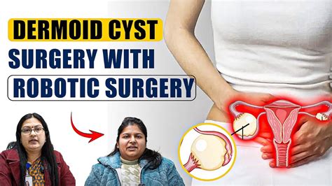 Australia To Apollo Hospital Delhi Dermoid Cyst Surgery By Dr Pakhee