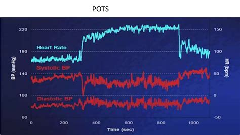 Assessment Of Autonomic Function Testpptx