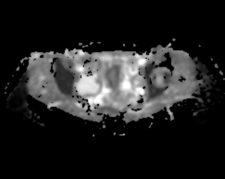 Image Radiopaedia Org