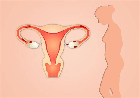 How Do Fibroids Cause Infertility Womens Pelvic Surgery Llc Urogynecologists