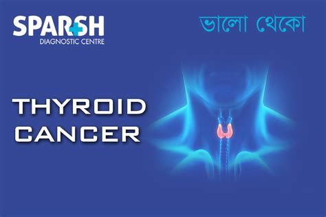 Thyroid Cancer Sparsh Diagnostic Center