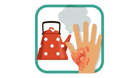 Manufacture Hyperbaric Chamber For Burns Unveiling The Healing Potential