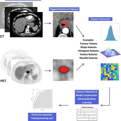 A Standard Radiomic Workflow Download Scientific Diagram