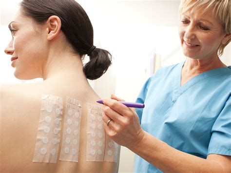 Contact Dermatitis Allergy Skin Test Results Chart