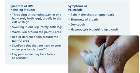 Venous Thromboembolism Vte Deep Vein Thrombosis And Pulmonary
