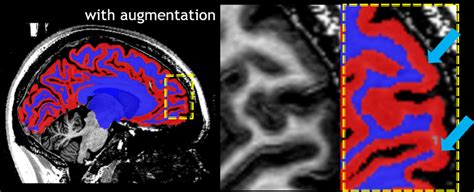 Compares Segmentation Results With And Without Training Data