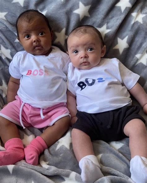 Mulher Dá à Luz Gêmeos Com Tons De Pele Completamente Diferentes Contilnet Notícias