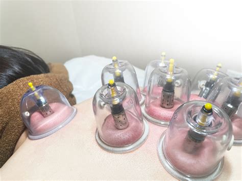 Tcm Treatment Service On Consultation And Wellness Therapy