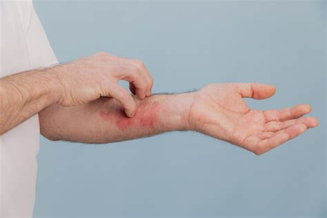 What Are The Steps For Alcohol Poisoning First Aid