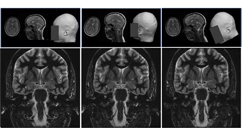 Intelligent Scanning Using Deep Learning For Mri By Tensorflow Tensorflow Medium
