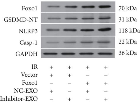Mir 27b 3p Inhibition And Foxo1 Expression Show Synergistically