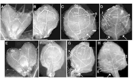 Vascular Pattern Development In The First Leaf Of Wild Type A D And