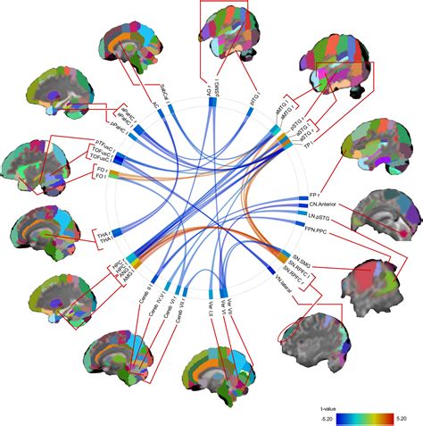 Comprehensive Elucidation Of Resting State Functional Connectivity In Anorexia Nervosa By A