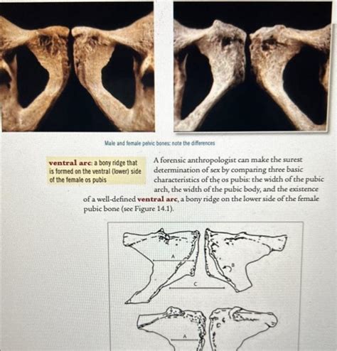 Bone Reading Notes Guide Using The Textbook Pages Chegg Com