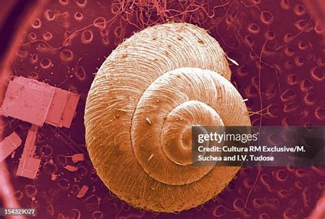 Environmental Scanning Electron Micrograph Photos And Premium High Res Pictures Getty Images