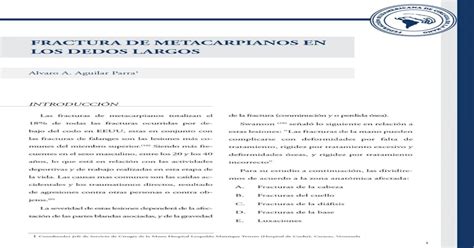 Fractura De Metacarpianos En Los Dedos Largos [pdf Document]
