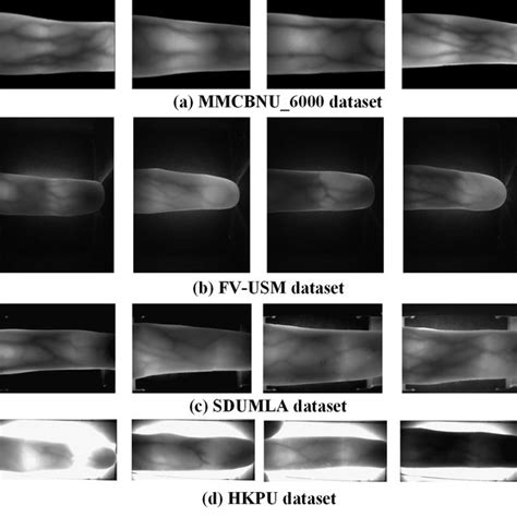 Pdf Adaptive Learning Gabor Filter For Finger Vein Recognition