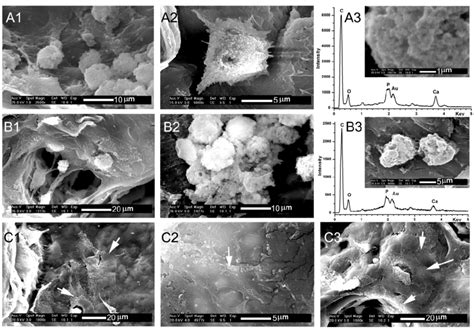 12 Sem Images And Edx Spectra Of Cp Cpp And Cpps Surfaces Seeded With Download Scientific