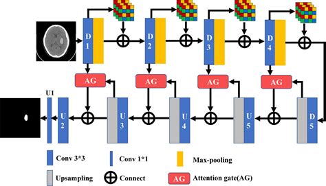Deep Learning Based Computed Tomography Image Segmentation And Volume Measurement Of
