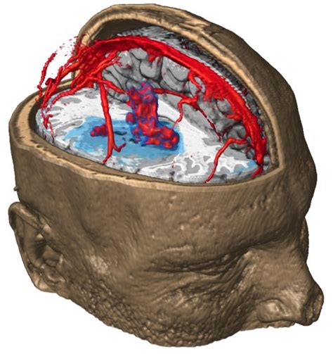 Mevislab Screenshots