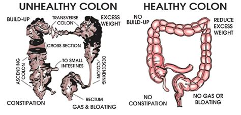 Colonic Hydrotherapy Machine Cost Maikong Colonic Machine Colon