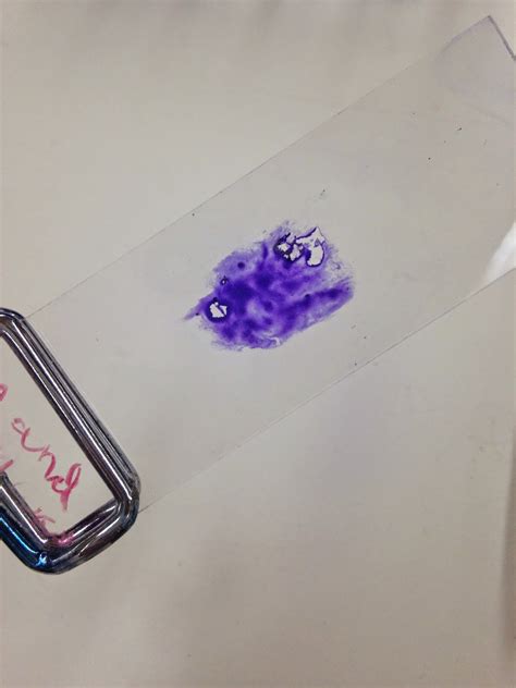 Microbiology Mania Gram Staining Including Simple Staining Method Lab May