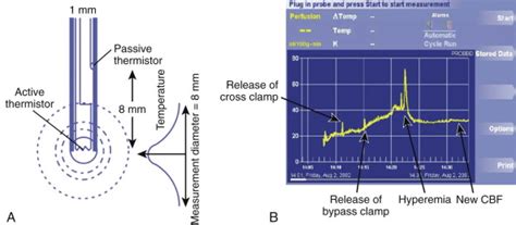 Laser Doppler Flowmetry Thermal Diffusion Flowmetry And Orthogonal