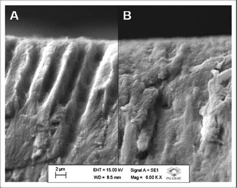 Scanning Electron Micrographs Of The Morphological Analysis Of The