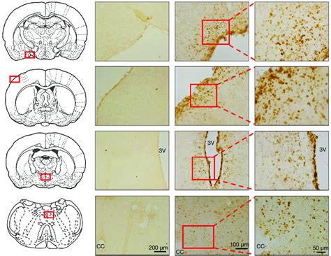 Gdnf Expressions Stained By Immunohistochemistry In The Multiple