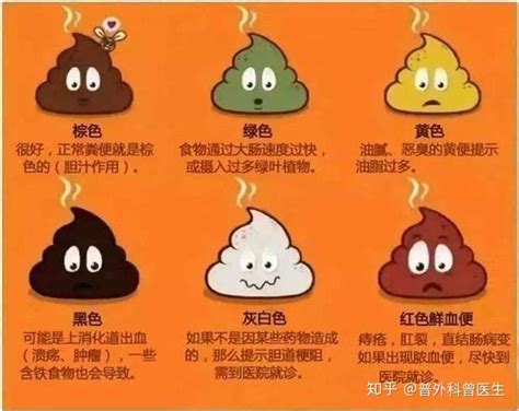 健康的大便需要满足7点，符合5点已经超神，完全符合的凤毛麟角 知乎