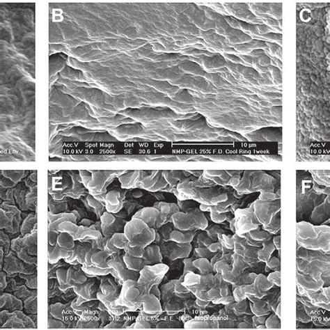 Sem Micrographs Showing The Different Surface Morphology Obtained By Download Scientific