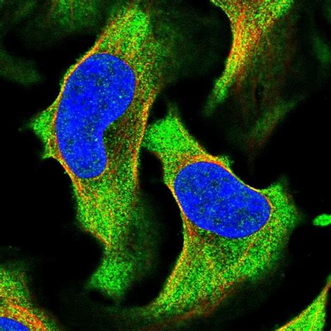 Rabbit Polyclonal Anti Prep Antibody Buy For Research Highly Specific Rigorously Validated