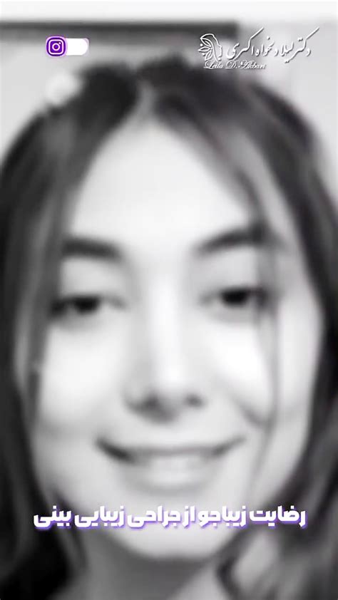 قبل و بعد جذاب از زیباجوی عزیز دکتر لیلا اکبری