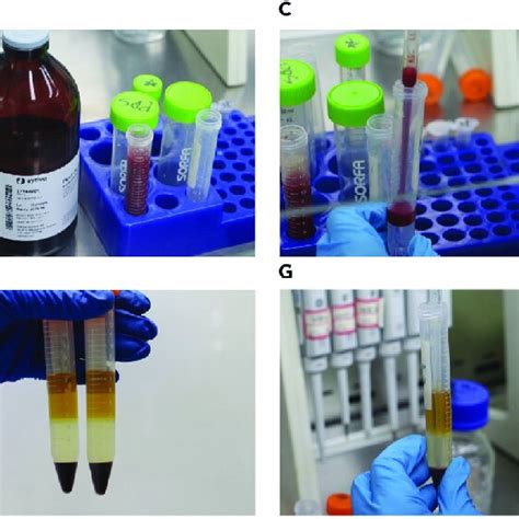 Isolation Of Human Peripheral Blood Mononuclear Cells Pbmcs A
