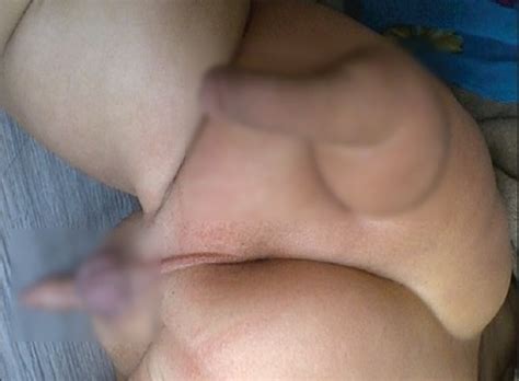 【本物】突然変異でチ コ（男性器）が2本ある男性の画像、凄すぎる！！！ ポッカキットポッカキット