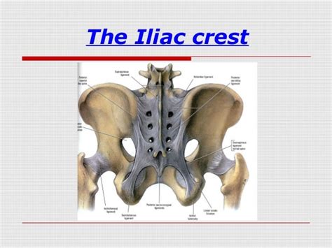 Bone Graft