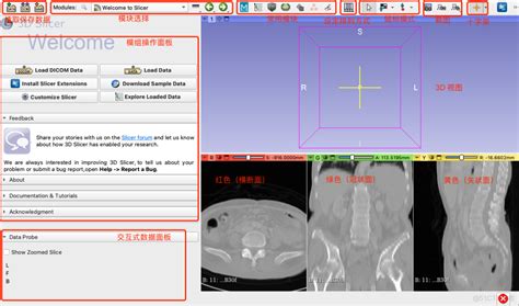 3d Slicer 最强大的开源医学图像分割工具简要概述51cto博客3d Unet 医学图像分割