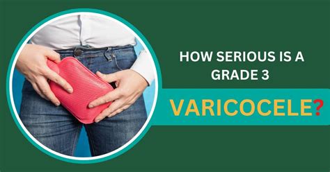 How Serious Is A Grade 3 Varicocele Bharat Homeopathy