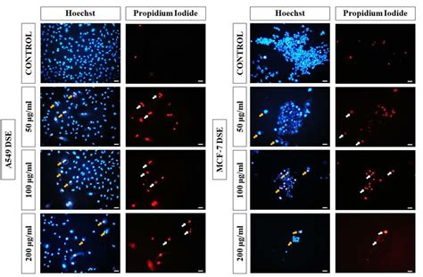 Hoechst And Propidium Iodide Fluorescent Staining Image Of Dse After 72