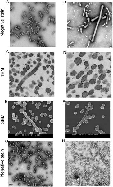 Pleomorphic Bacteria