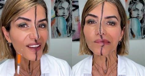 한쪽 얼굴에만 보톡스 자기 얼굴에 실험한 의사가 내린 결론