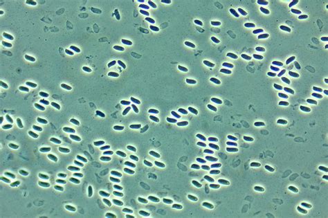 Phase Contrast Sequence Diagram Zeiss Microscopy Online Camp