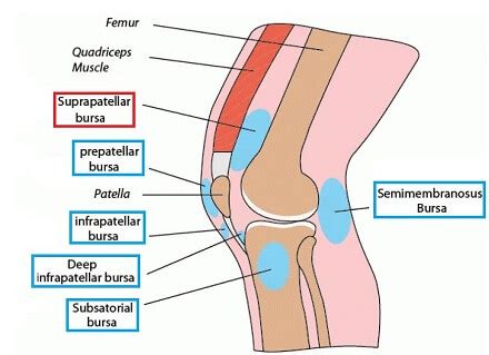 Bursitis Lateral Side Of Knee
