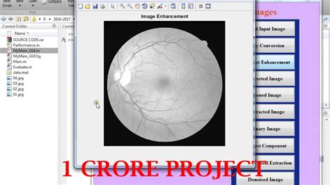 Vessel Extraction In Retinal Images Using Morphological Filters 1crore Projects Youtube
