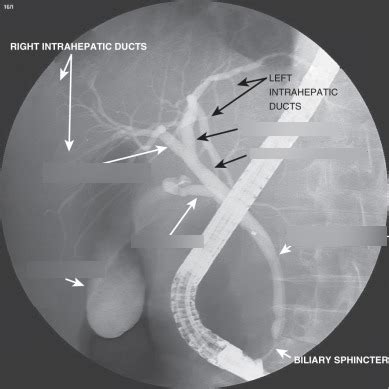 ERCP Diagram Quizlet