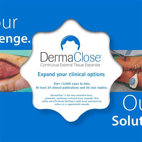 Dermaclose Continuous External Tissue Expander Youtube